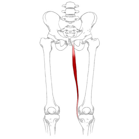 Gracilis Muscle Strain