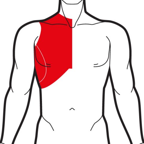 Trigger Point eBook: Shoulder, Chest & Thorax