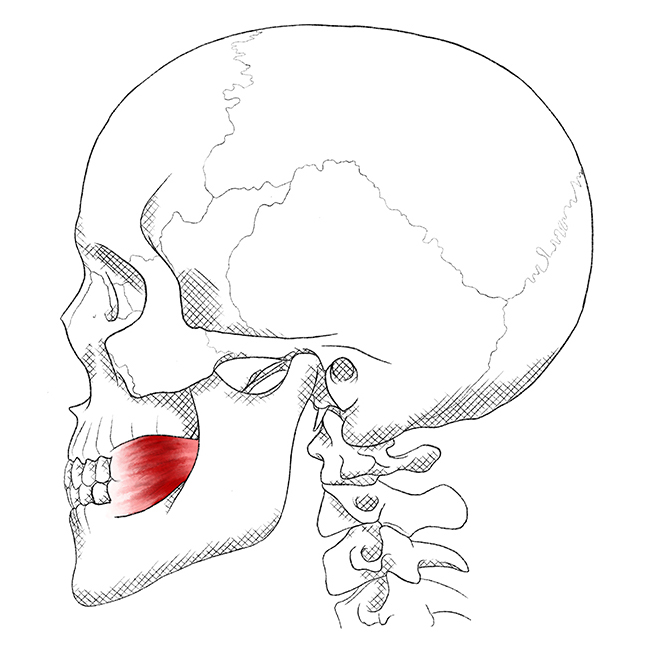 Buccinator – Pain & Trigger Points