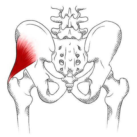 Gluteus Minimus – Pain & Trigger Points