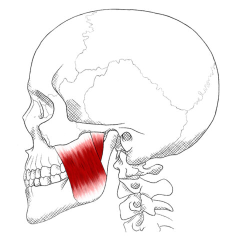 Masseter – Pain & Trigger Points