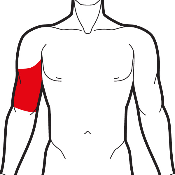 Trigger Point eBook: Upper Arm & Elbow