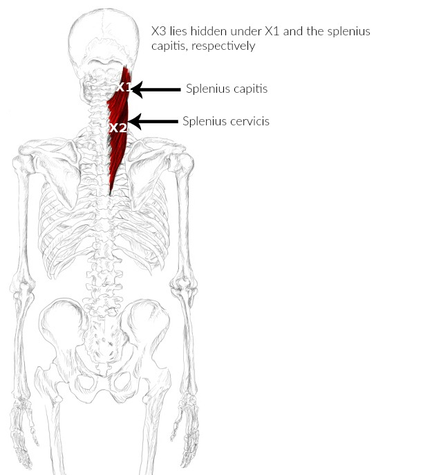 Splenius capitis & cervicis pain & trigger points