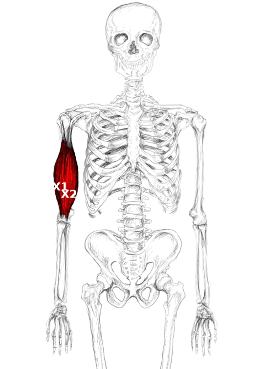 Triceps Brachii Trigger Referred Muscles Triggerpoints Trizeps ...