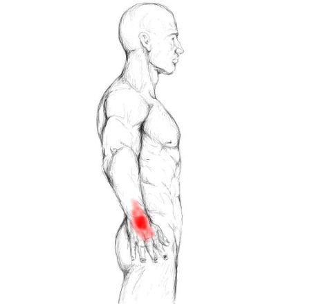 Extensor carpi radialis brevis pain & trigger points