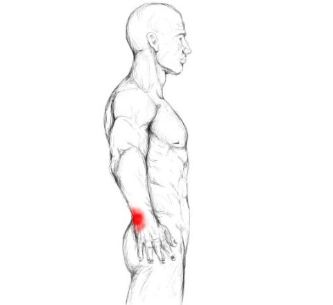 Extensor carpi ulnaris pain & trigger points