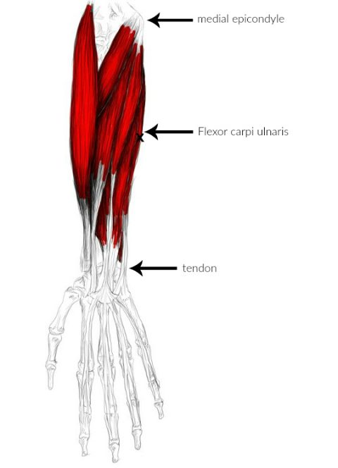 Extensor Carpi Ulnaris Pain & Trigger Points 5C8