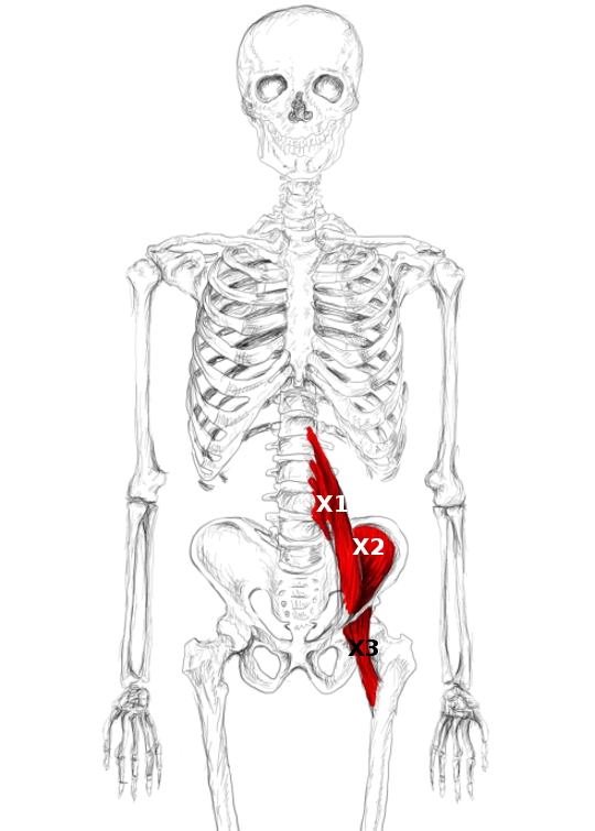 Iliopsoas muscle pain & trigger points Iliopsoas muscle pain & trigger points