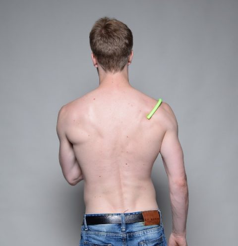 Infraspinatus muscle pain & trigger points