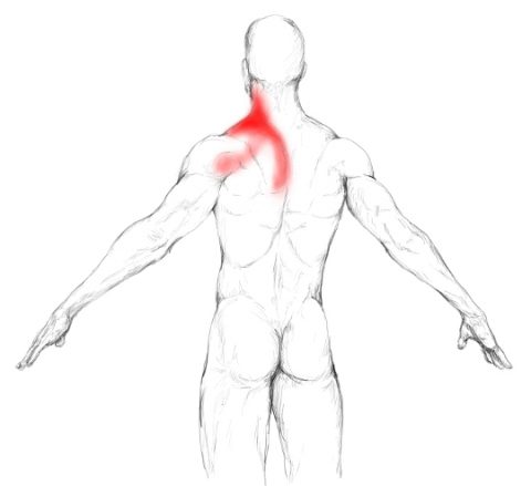 Levator Scapulae Trigger Points Rhomboid Trigger Points: A Pain