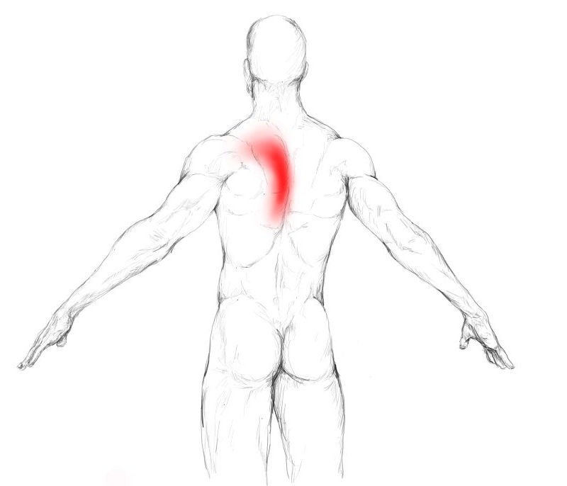 Rhomboid pain & trigger points
