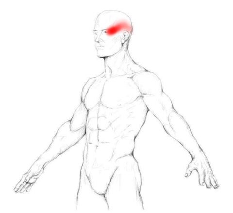 Splenius capitis & cervicis pain & trigger points