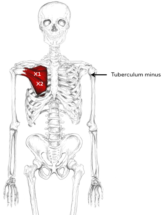 Subscapularis muscle pain & trigger points