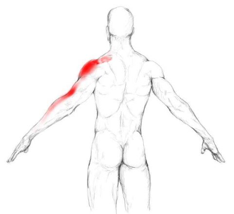 Supraspinatus pain trigger points